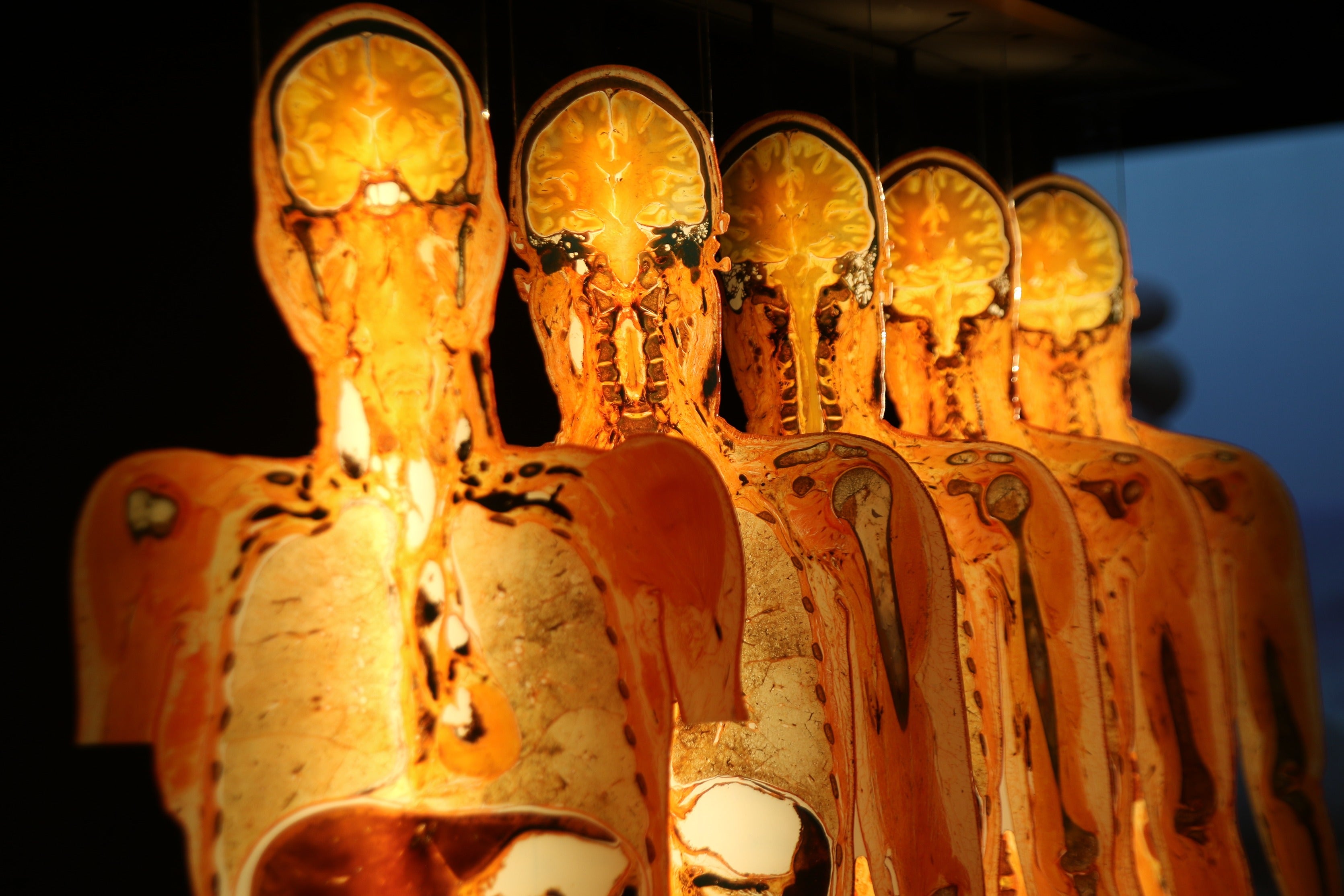 Human body exhibit at Franklin Institute runs through Sept. 1 - WHYY